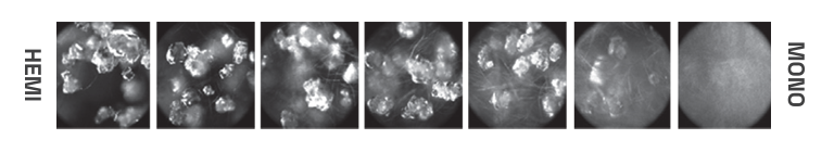 Crystallization Development | Veranova